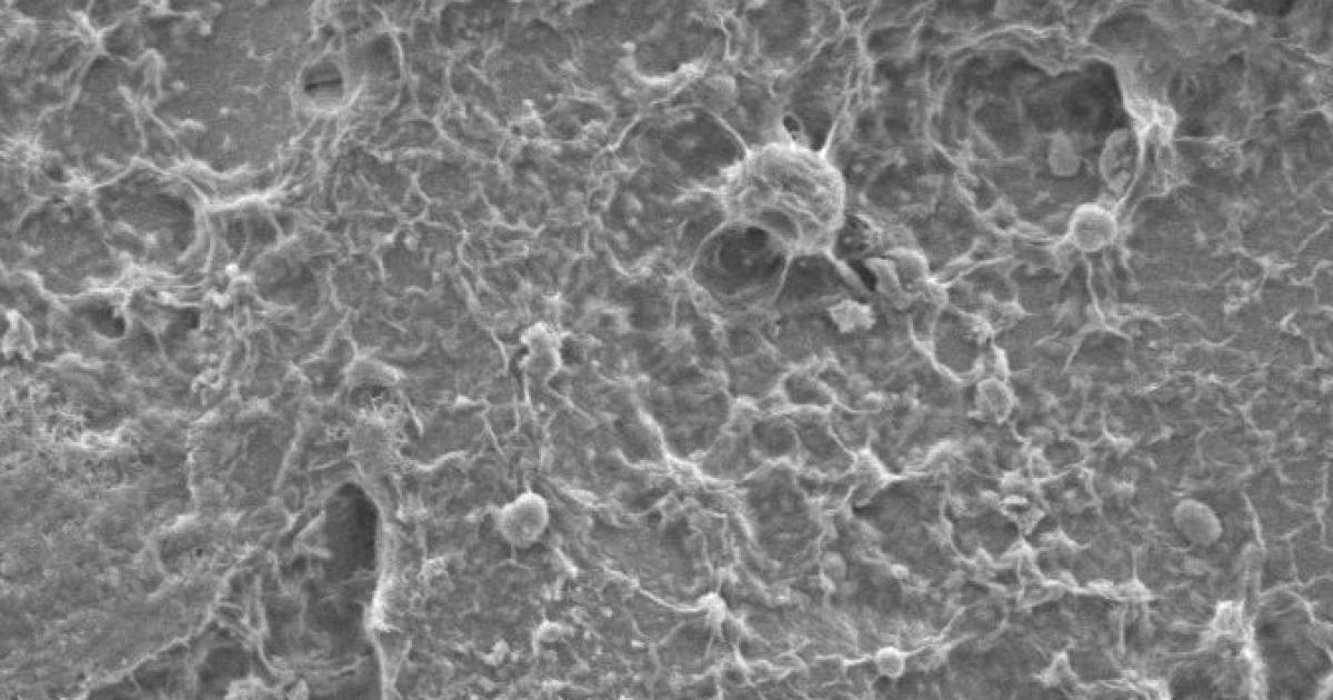 Ancient community of undersea microbes may resemble early life on Earth ...
