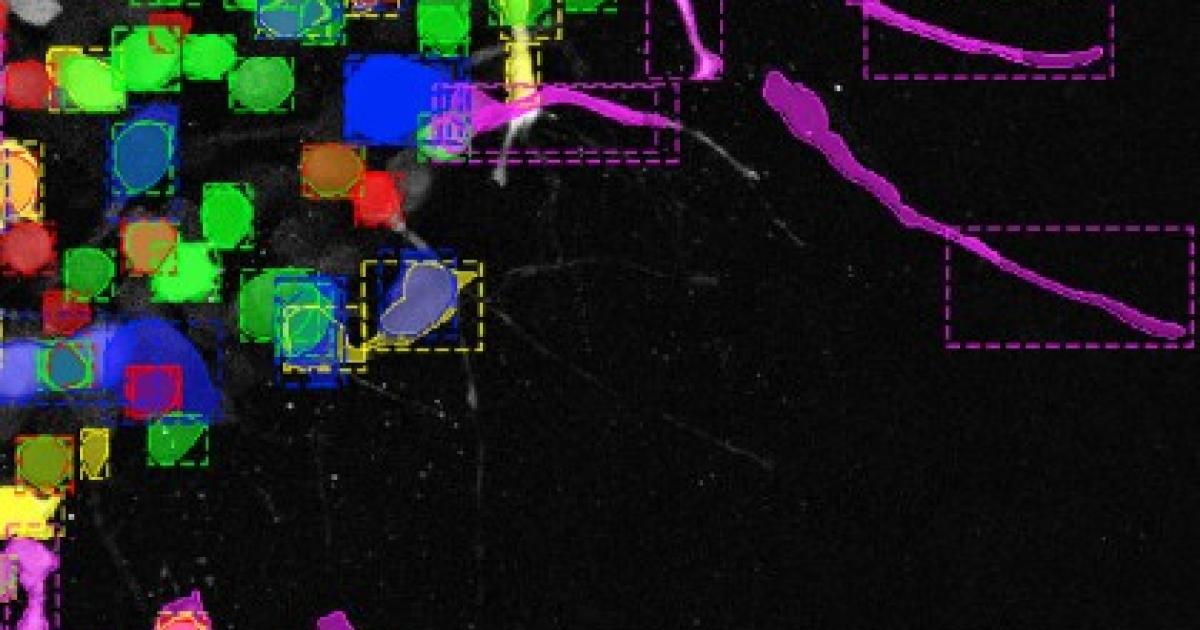 Cancer cells change shape, how they move to invade different types of ...