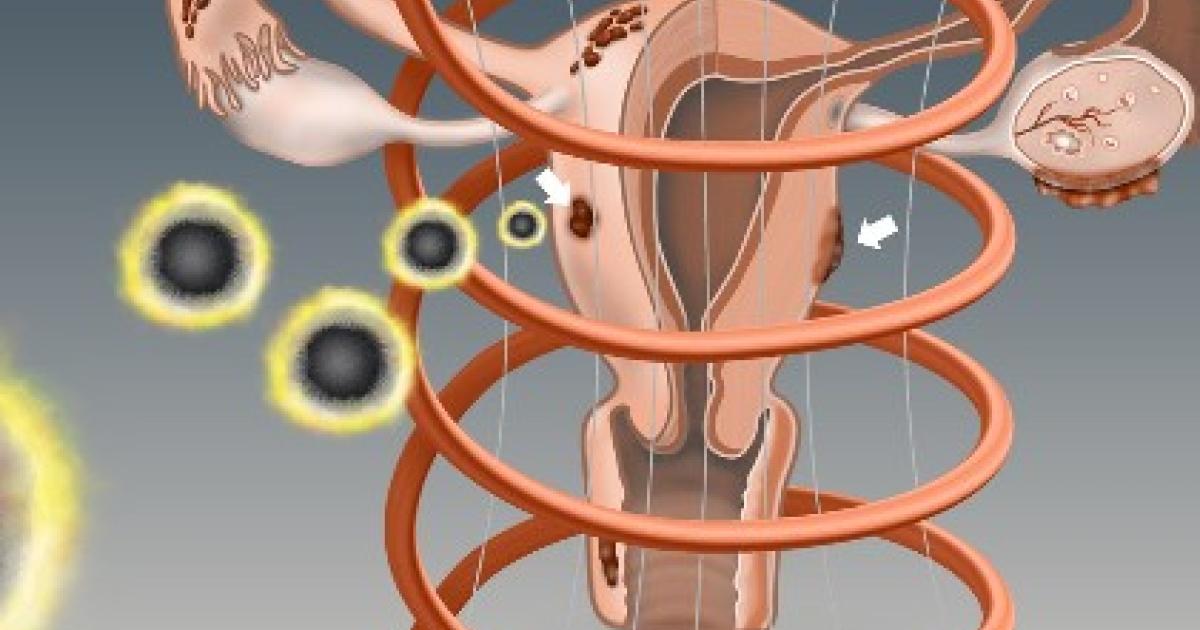 Nanoparticles developed at OSU show promise for locating, removing ...