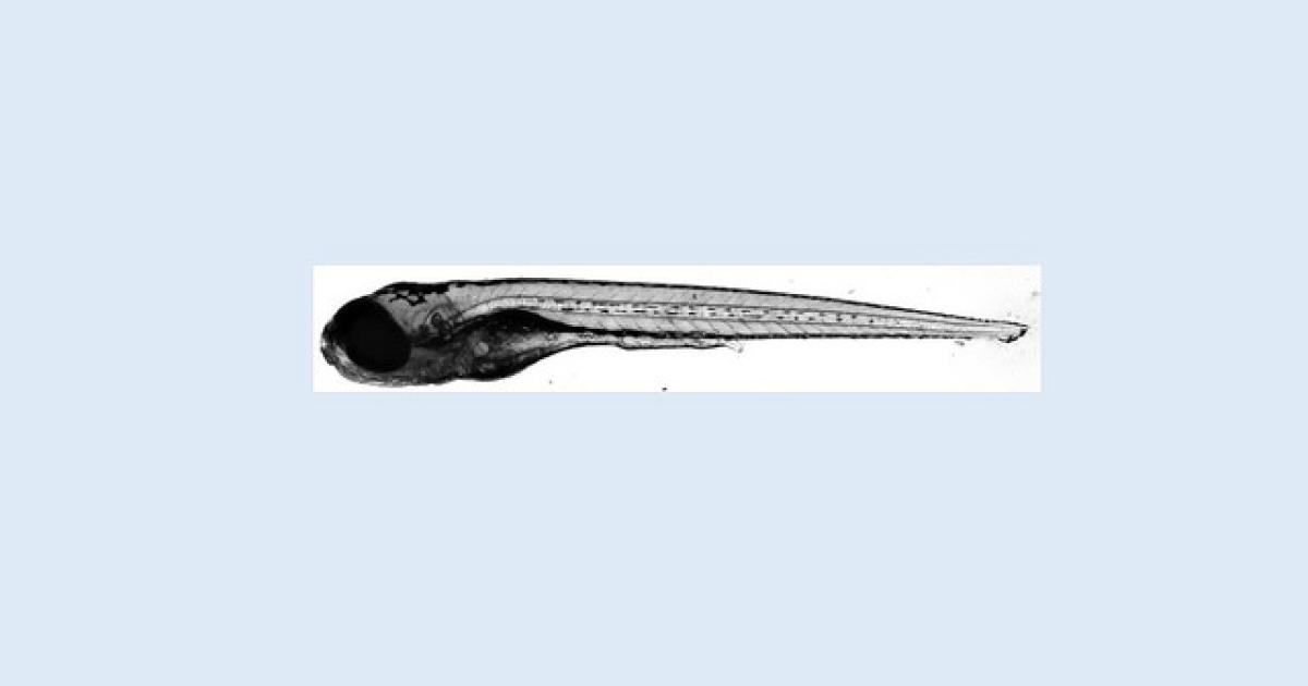 Zebrafish study provides new insights into autism spectrum disorder ...